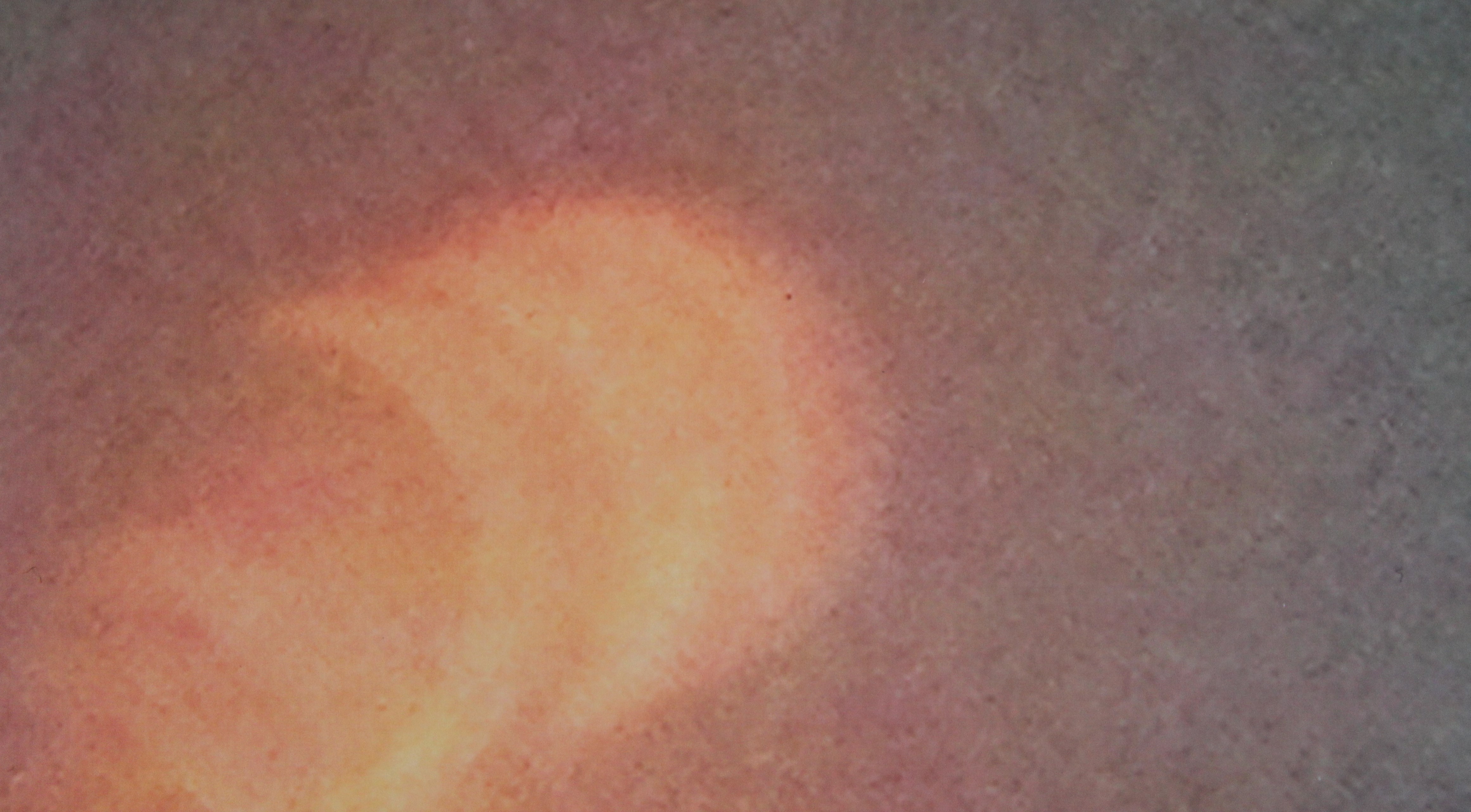 Callanish: lunar standstills and an Equinox solar eclipse – Earth ...
